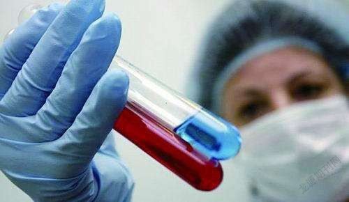 5种常见癌症有望在早期发现