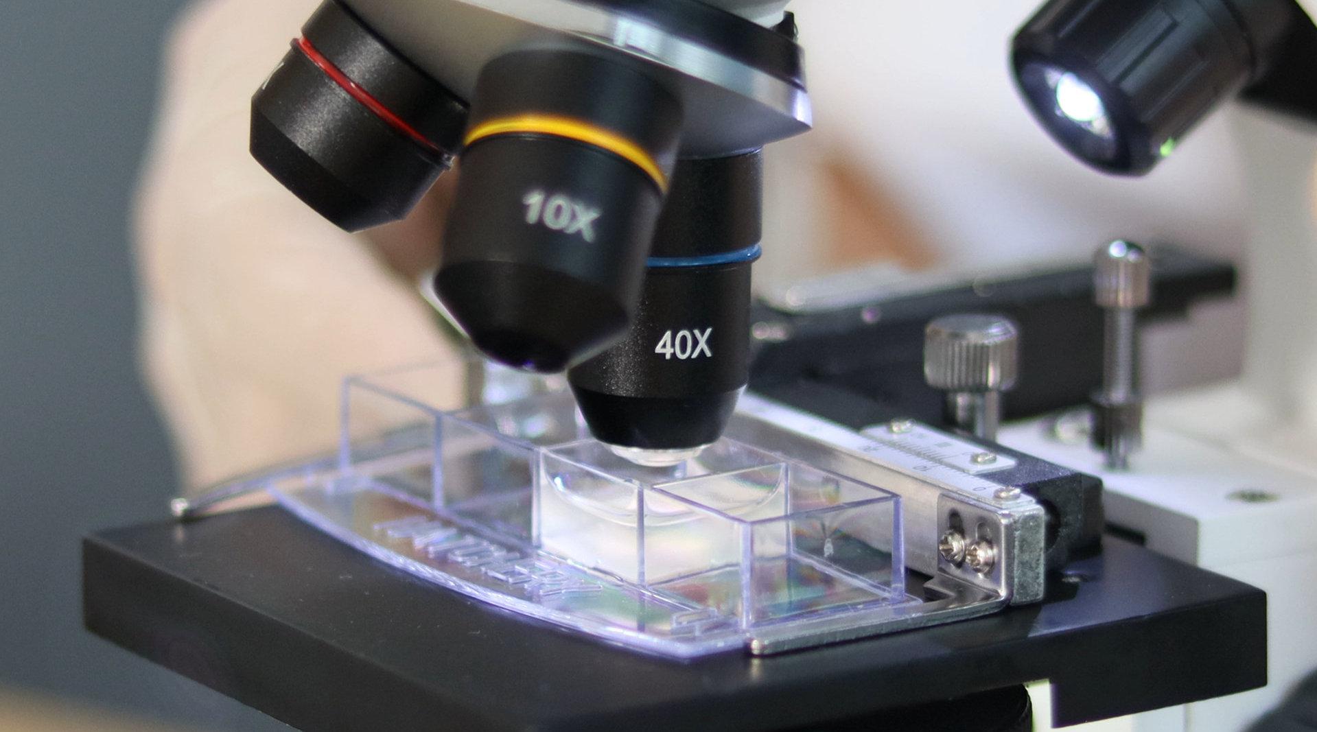 魔力科学小实验，酵母菌显微镜下放大1600倍后，你看到了啥？！_新浪新闻