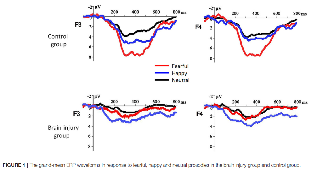 突破！脑电/事件相关电位一体机 获批上市