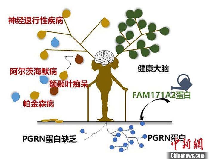 中美专家携手发现新基因 成阿尔茨海默病等防治潜在新靶点|中美|退行性|基因_新浪新闻