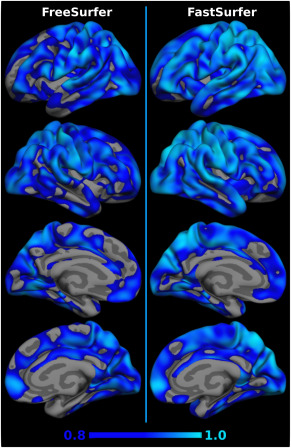 FastSurfer深度学习脑部成像工具：1分钟脑部分割，1小时皮质重建！_创事记_新浪科技_新浪网