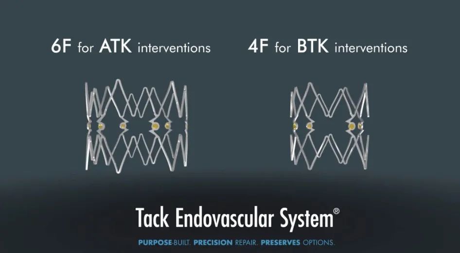 飞利浦3.6亿美元收购Intact Vascular公司，强化介入治疗业务__财经头条