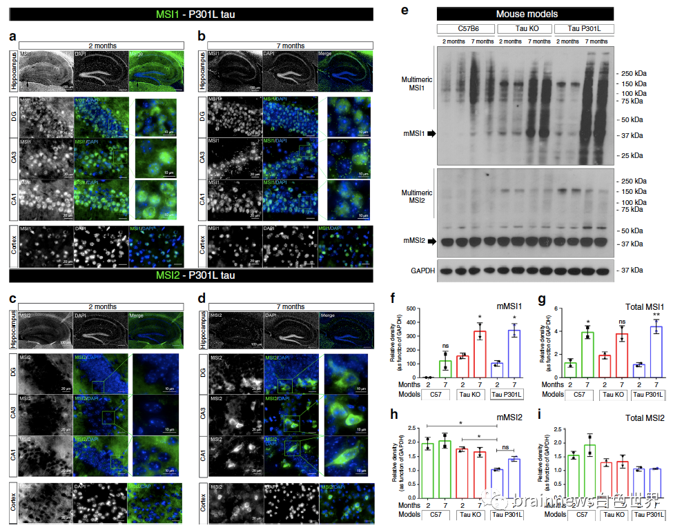 NC：神经退行性疾病研究新方向——MSI/tau蛋白的相互作用|细胞核_新浪新闻