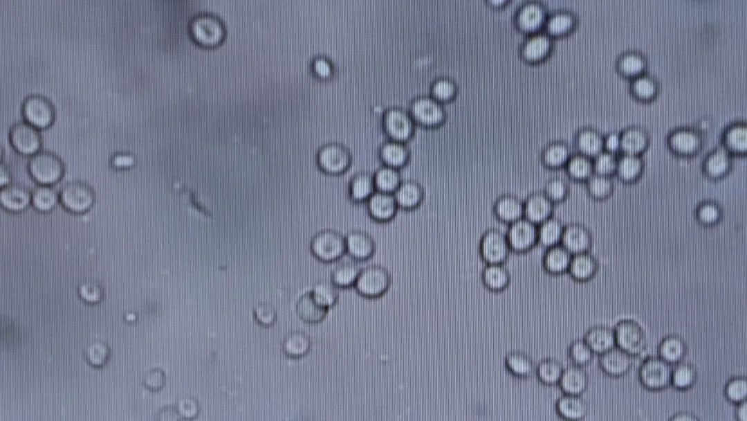 科学实验 | 能做馒头的酵母菌长啥样？放大1600倍给大家看看_新浪新闻