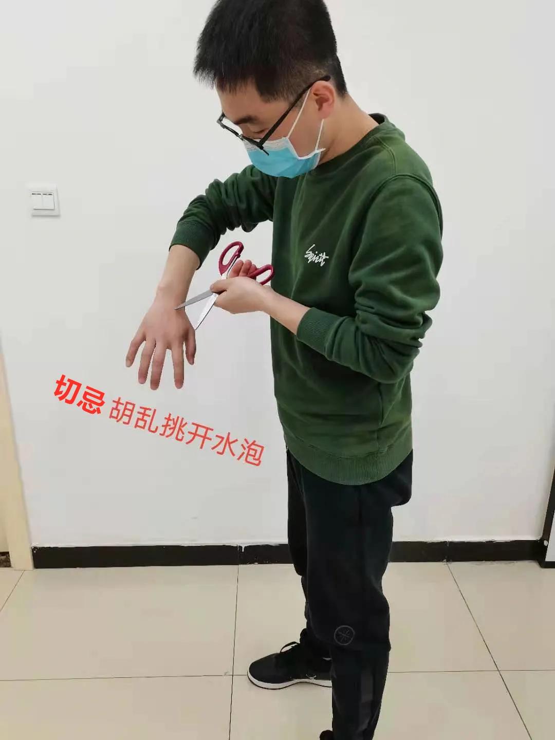 陕中二附院：意外烫伤怎么办？这套处理方法值得收藏
