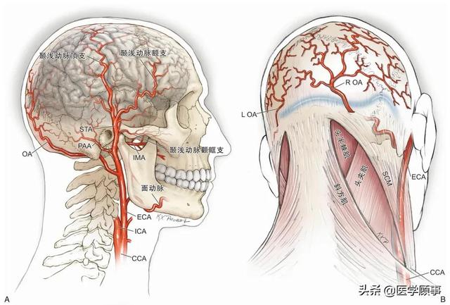 脑血管吻合：供体动脉和受体动脉