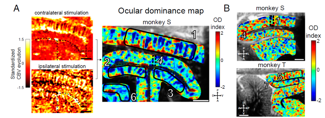 fUS技术专题| 全新的脑功能成像技术在非人灵长类相关研究汇编