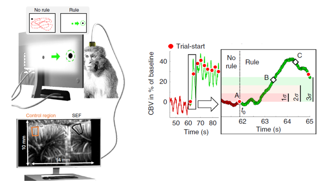 fUS技术专题| 全新的脑功能成像技术在非人灵长类相关研究汇编