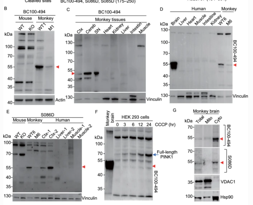 「颠覆」PINK1线粒体自噬理论，新研究为帕金森病药物研发提供新思路，根治疗法已提上日程丨独家专访李晓江__财经头条