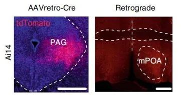 Nat Neurosci：揭秘mPOA参与焦虑和亲职行为的神经调控机制|和亲_新浪新闻
