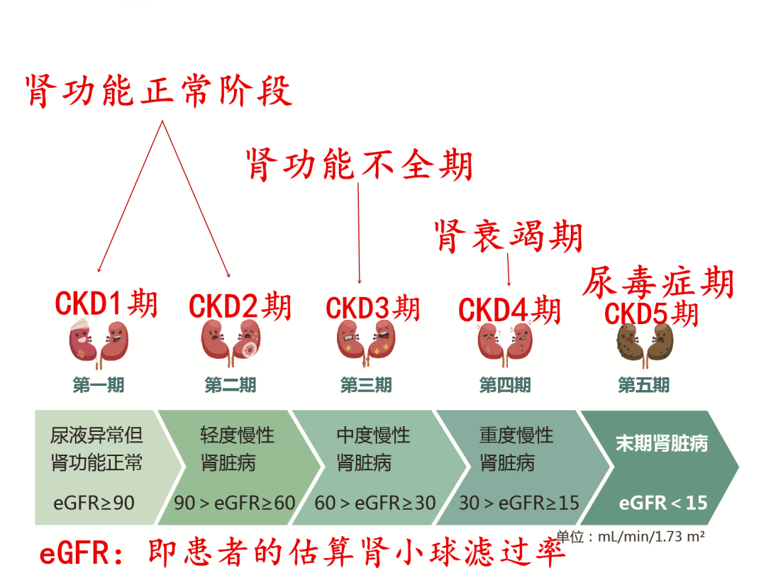 病理分级和肾功能分期（CKD分期）是两码事，别再弄混了！