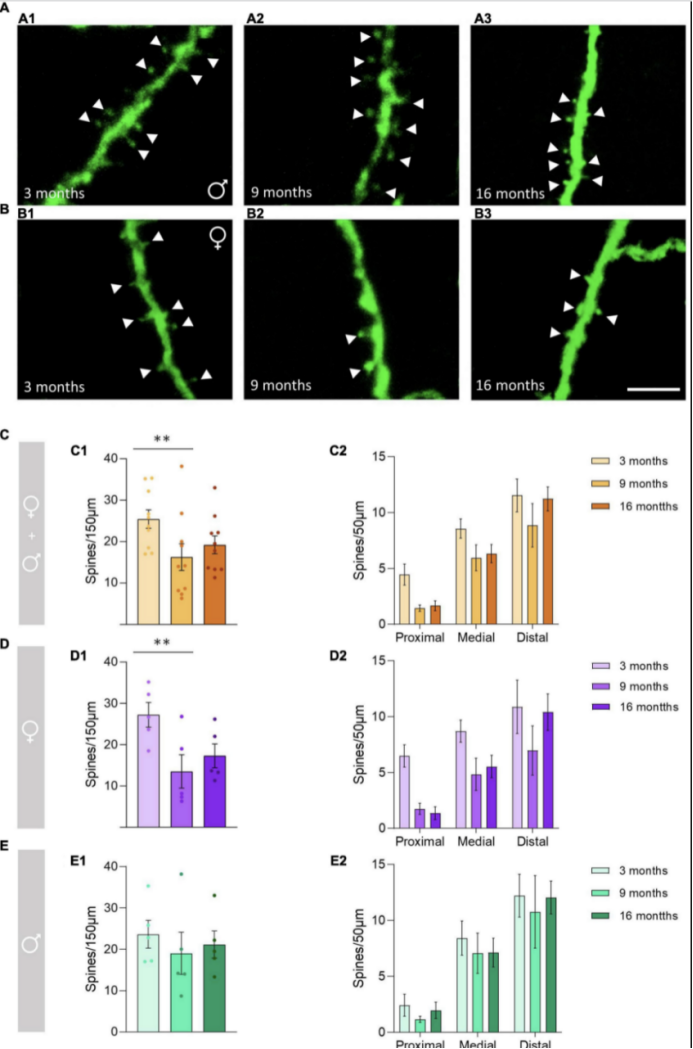 Front.aging.neurosci- 衰老对小鼠海马神经元NMDA的影响|神经元|树突棘|海马_新浪新闻