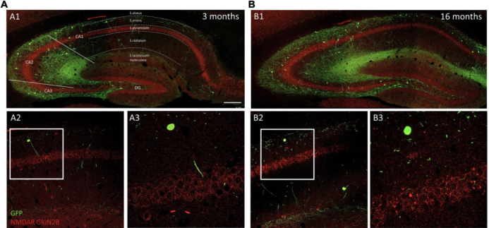 Front.aging.neurosci- 衰老对小鼠海马神经元NMDA的影响|神经元|树突棘|海马_新浪新闻