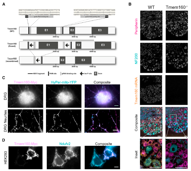 Cell子刊：神经病理性疼痛研究 新进展|基因_新浪新闻
