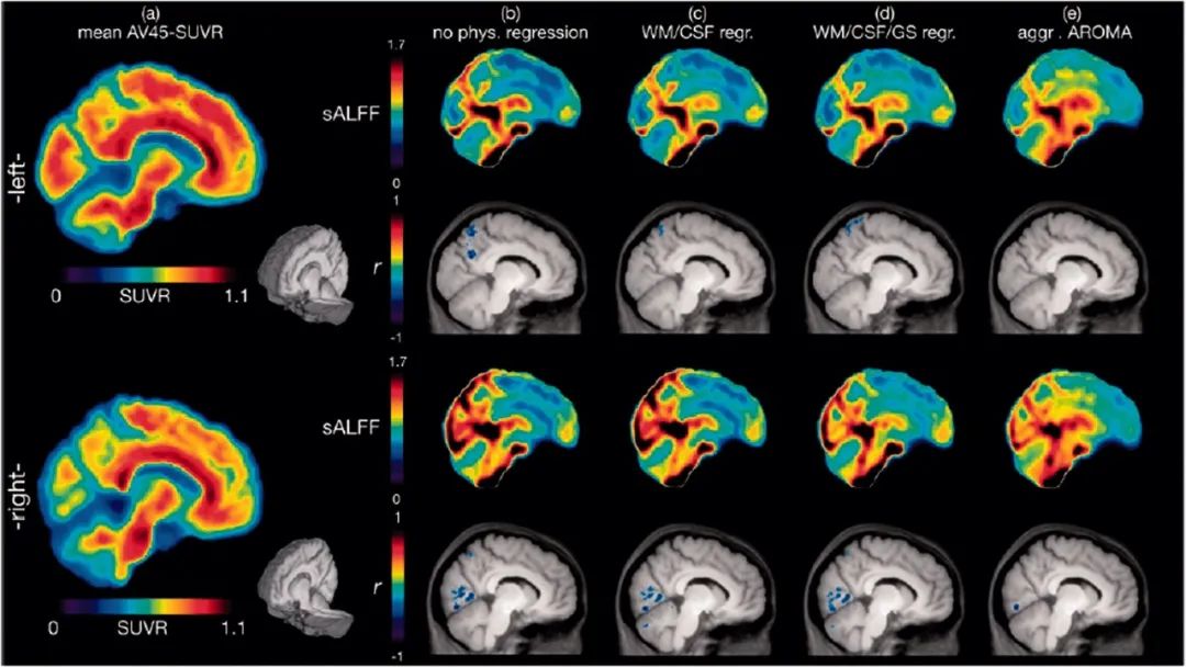 文献汇编 I 结构和功能MRI成像应用于脑血管和认知障碍疾病预测__财经头条
