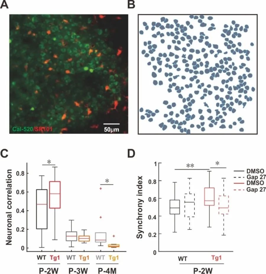 Neurosci Bull：星形胶质细胞影响孤独症大脑中神经元异常同步__财经头条