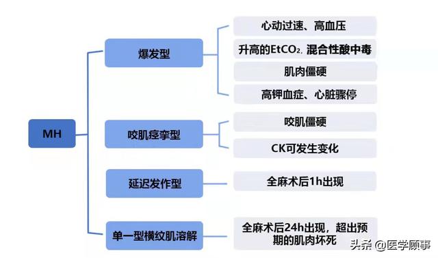 丹曲林钠治疗恶性高热__财经头条