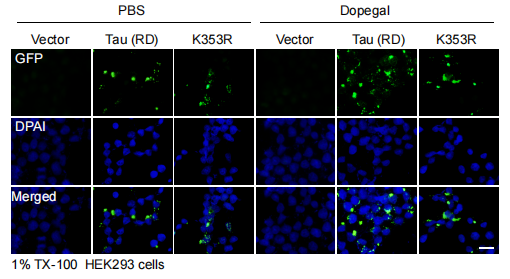 Nature子刊：叶克强/张振涛合作揭示脑内Tau蛋白聚集的分子机制|蛋白|张振涛|蓝斑_新浪新闻