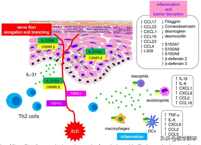 瘙痒新药获批：IL-31R抗体Nemolizumab|日本_新浪新闻