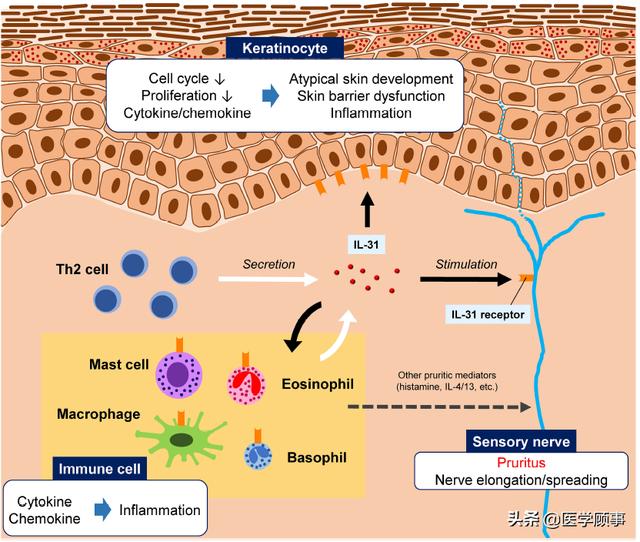 瘙痒新药获批：IL-31R抗体Nemolizumab|日本_新浪新闻