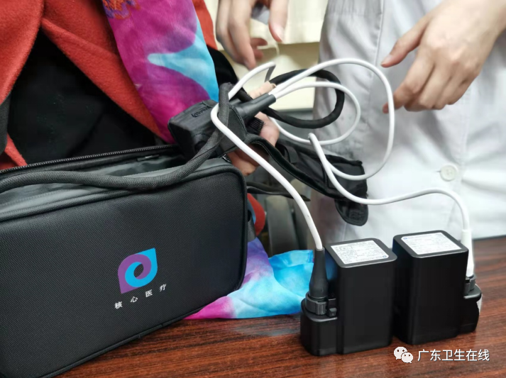 全球最小人工心脏在广东“跳动”|心衰_新浪新闻