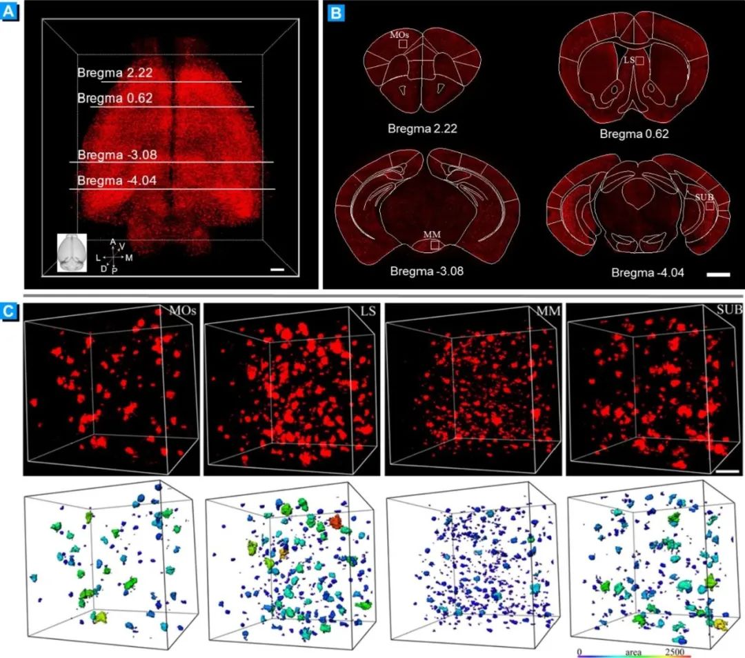 盘点：fMOST结合荧光探针实现全脑Aβ斑块的自动三维成像|三维成像|斑块|荧光_新浪新闻