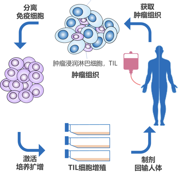 一位病人的“新生”：TIL细胞免疫疗法能否有广阔未来？|肿瘤_新浪财经_新浪网