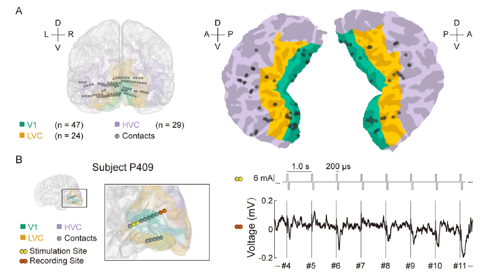 方方/王茜团队揭示theta与gamma神经振荡在视皮层功能连接的作用__财经头条