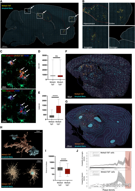Immunity：细分大脑巨噬细胞亚群