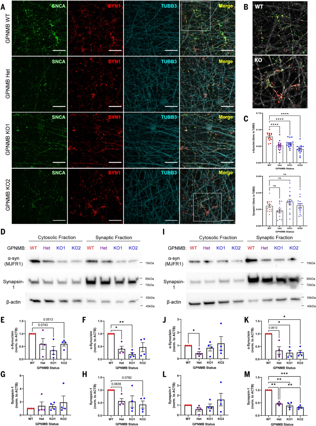 Science：帕金森病的风险基因——GPNMB