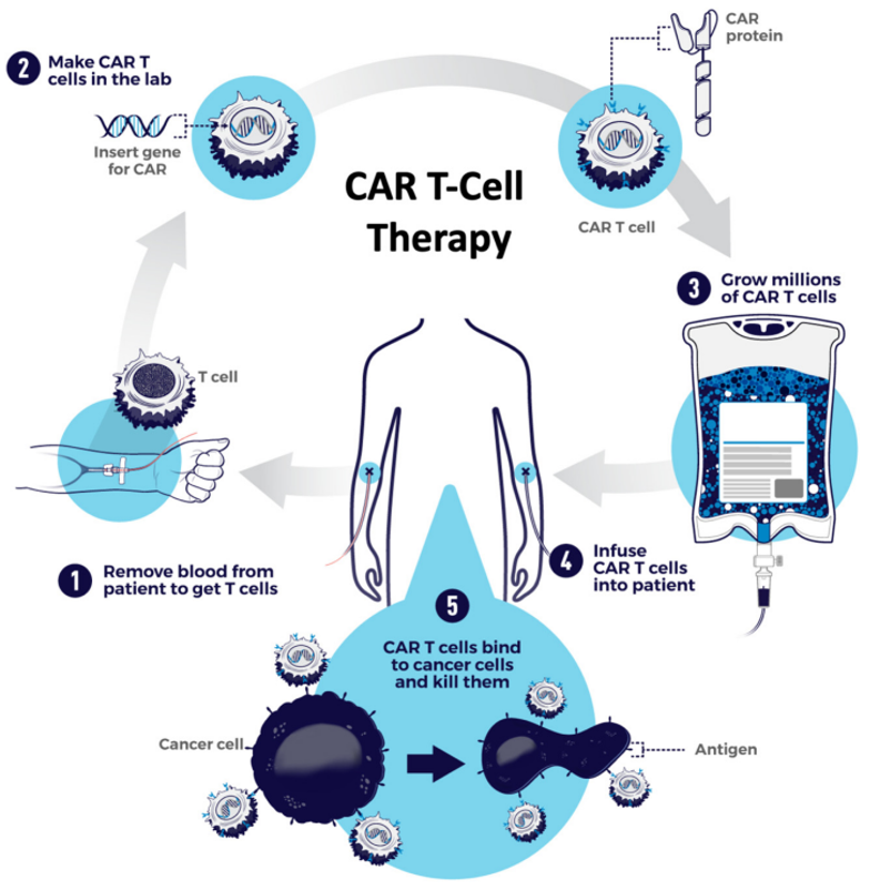 百年细胞治疗史，CAR-T未来如何突破？|CAR-T|肿瘤_新浪新闻