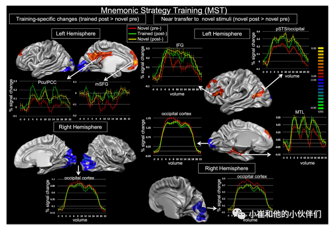 Alzheimer's & Dementia最新：这样训练，可有效改善轻度认知障碍__财经头条