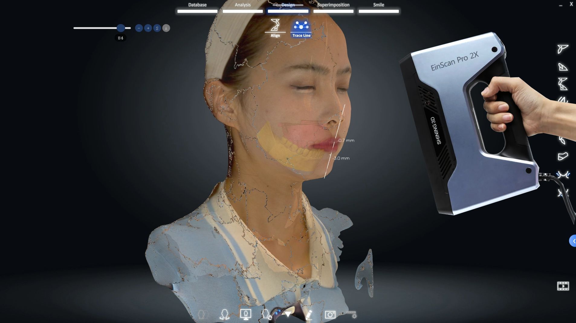 数字化正畸01：面部3D扫描仪+Accu3DX初体验|3D|扫描仪_新浪新闻