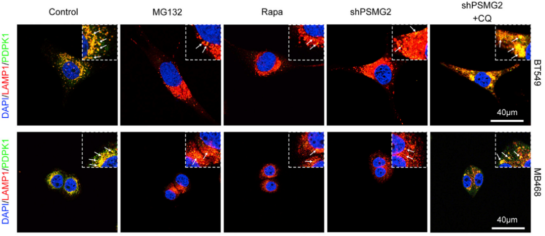 治疗最凶险的乳腺癌，华西团队联合靶向MEK和蛋白酶体提供新思路|肿瘤_新浪新闻