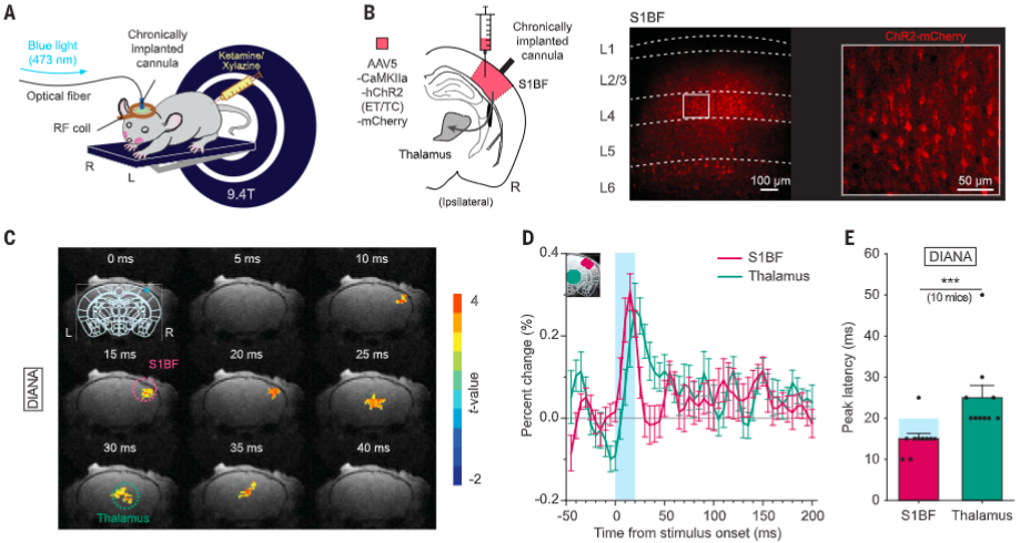 Science重磅研究：高时空分辨率的MRI成像__财经头条