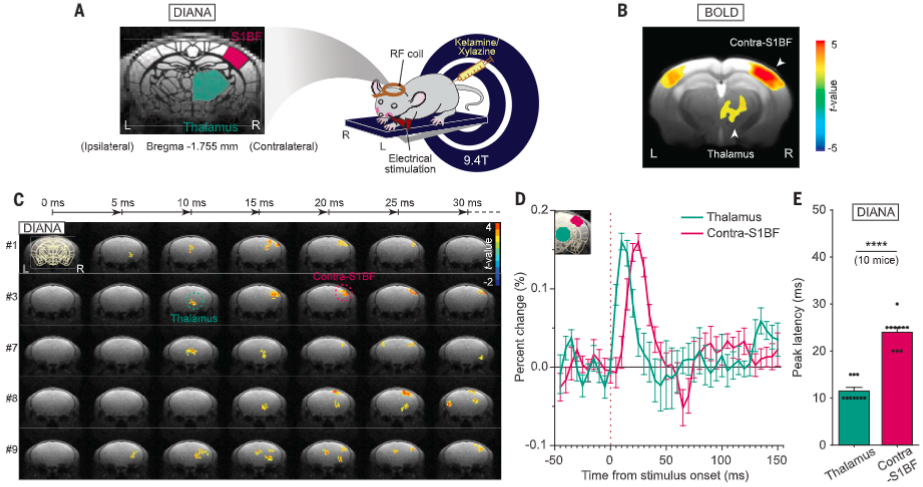 Science重磅研究：高时空分辨率的MRI成像|神经元|成像|丘脑_新浪新闻
