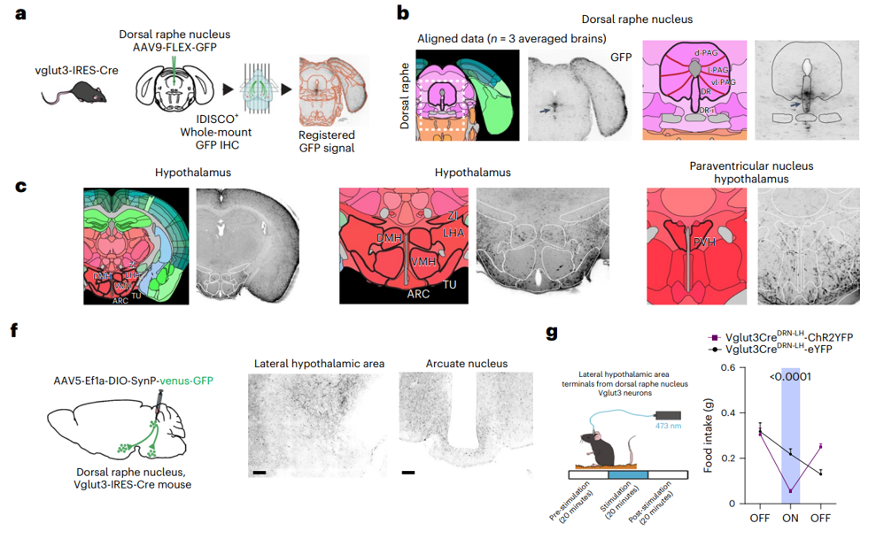 Nat Metabolism：减肥，可靶向这类神经元__财经头条