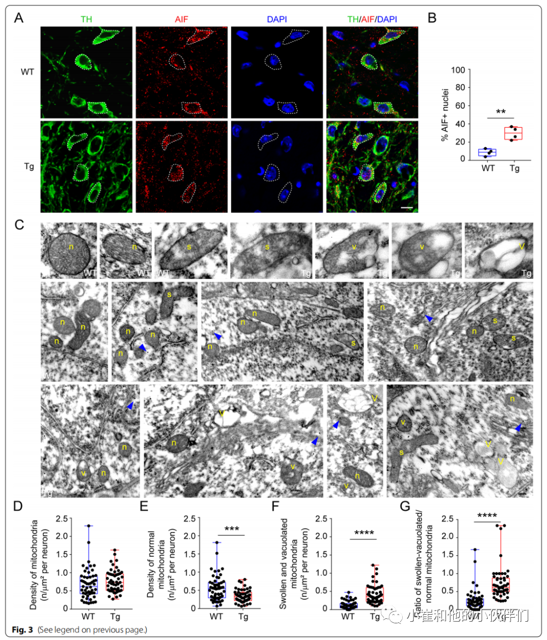 Mol Neurodegener：调控AD早期VTA多巴胺神经元存活的新机制