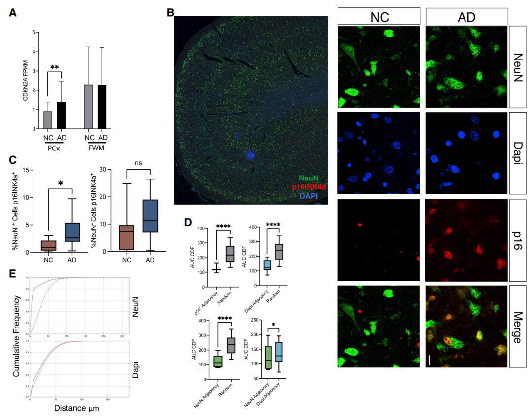Cell Stem Cell：衰老神经元构成了阿尔兹海默症患者晚年大脑炎症的神经性来源|基因_新浪新闻
