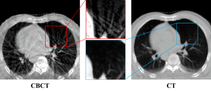 科学家通过跨域融合网络，实现图像的有效配准__财经头条