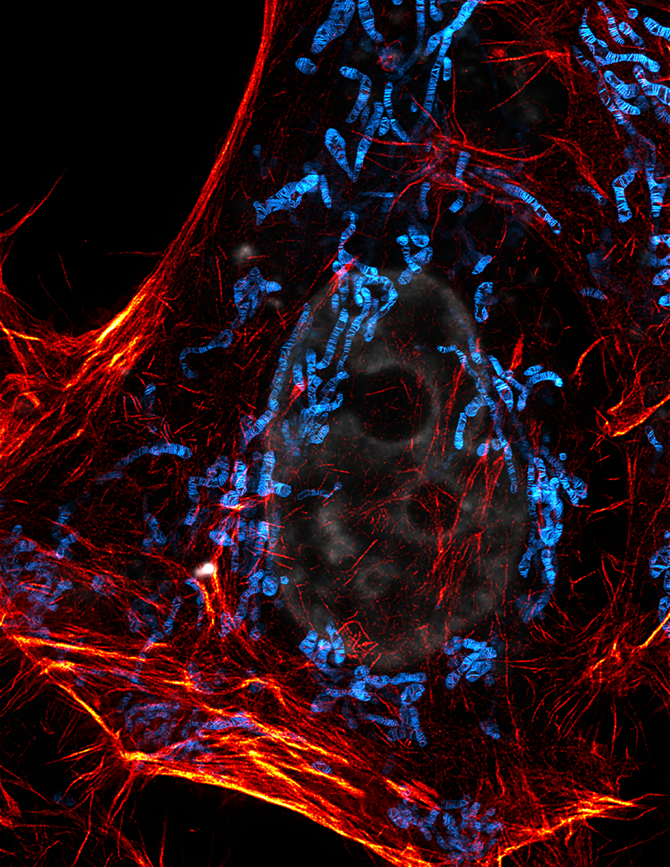 PNAS封面：北大陈知行团队研发新探针实现线粒体多色STED成像|显微镜|活细胞|北京大学_新浪新闻