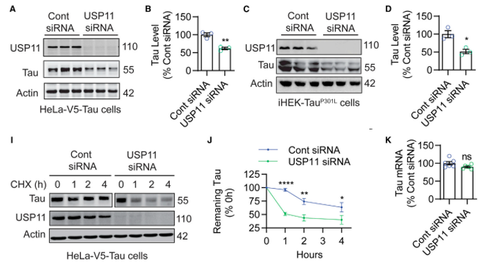 Cell: 女性更易患阿尔兹海默症的可能机制，为临床早筛提供方向|Cell|乙酰|女性_新浪新闻