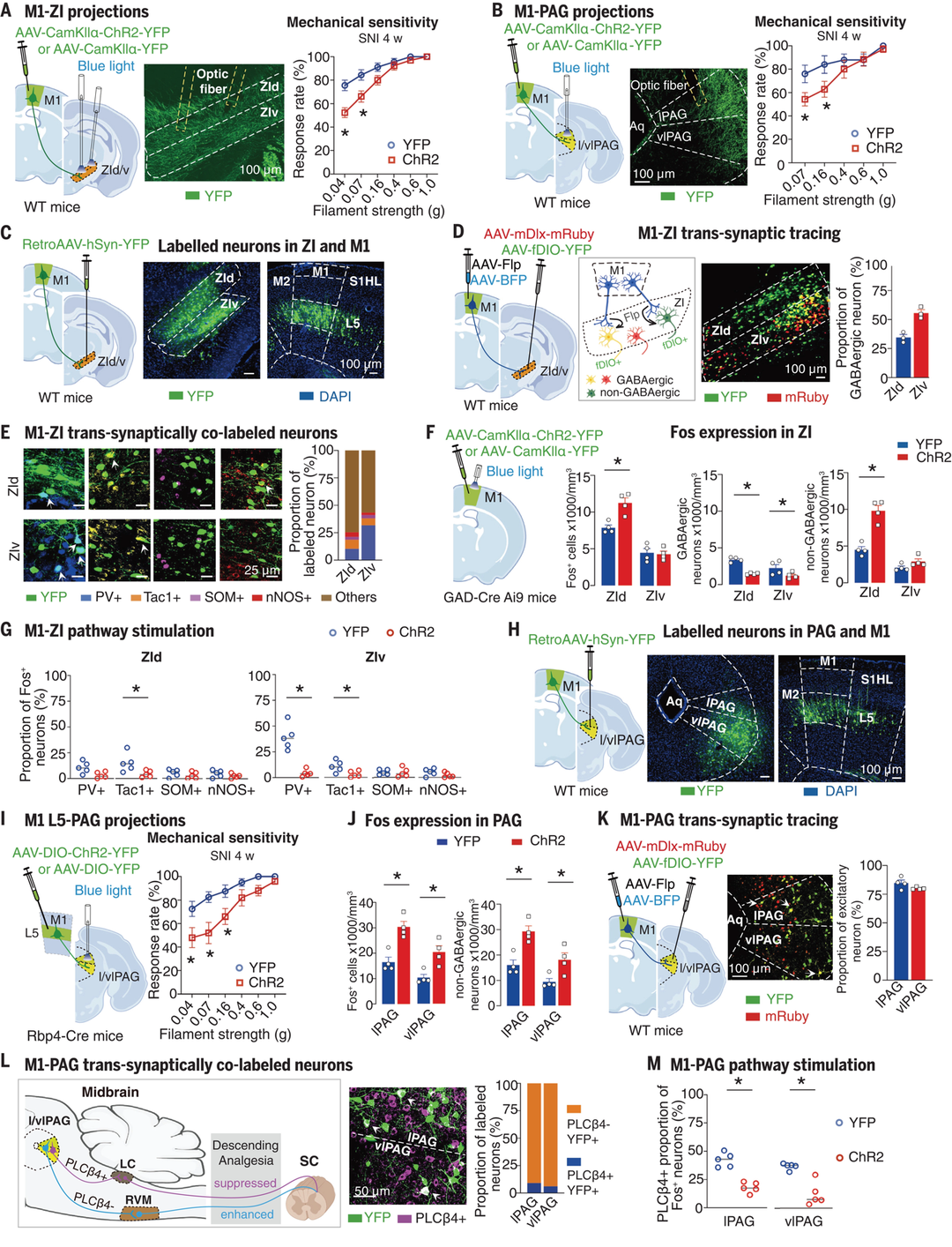 Science：初级运动皮层缓解疼痛的精细环路