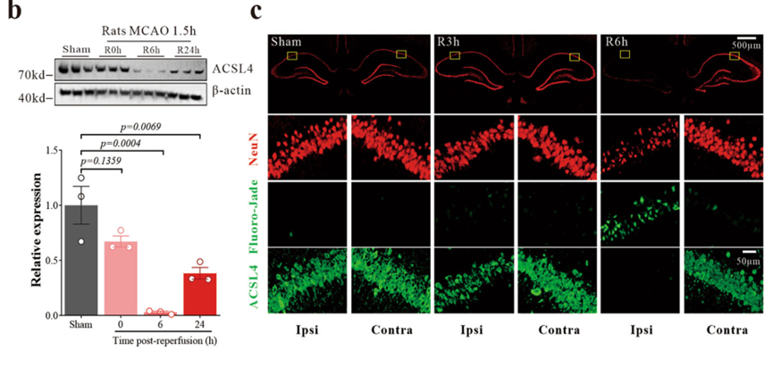 STTT：川大团队报道脑缺血再灌注中凝血酶诱导ACSL4依赖性铁死亡|凝血酶|脑卒中|死亡_新浪新闻