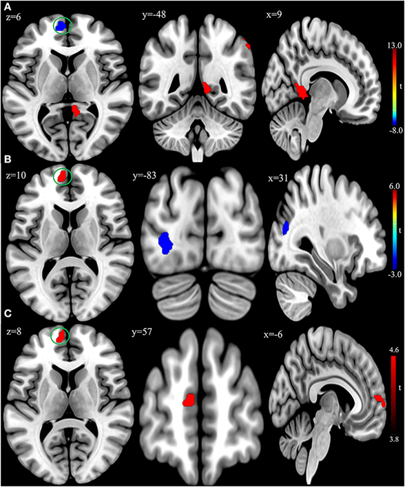 Frontiers in Neurosci: 重复经颅磁刺激（rTMS）研究新进展