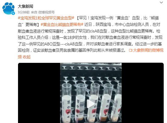 罕见!宝鸡发现一例 黄金血”血型,比 熊猫血”更稀有手机新浪网