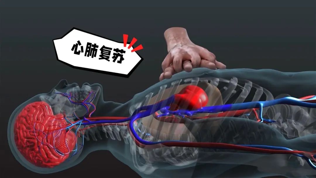 图文 | 如何正确开展心肺复苏？
