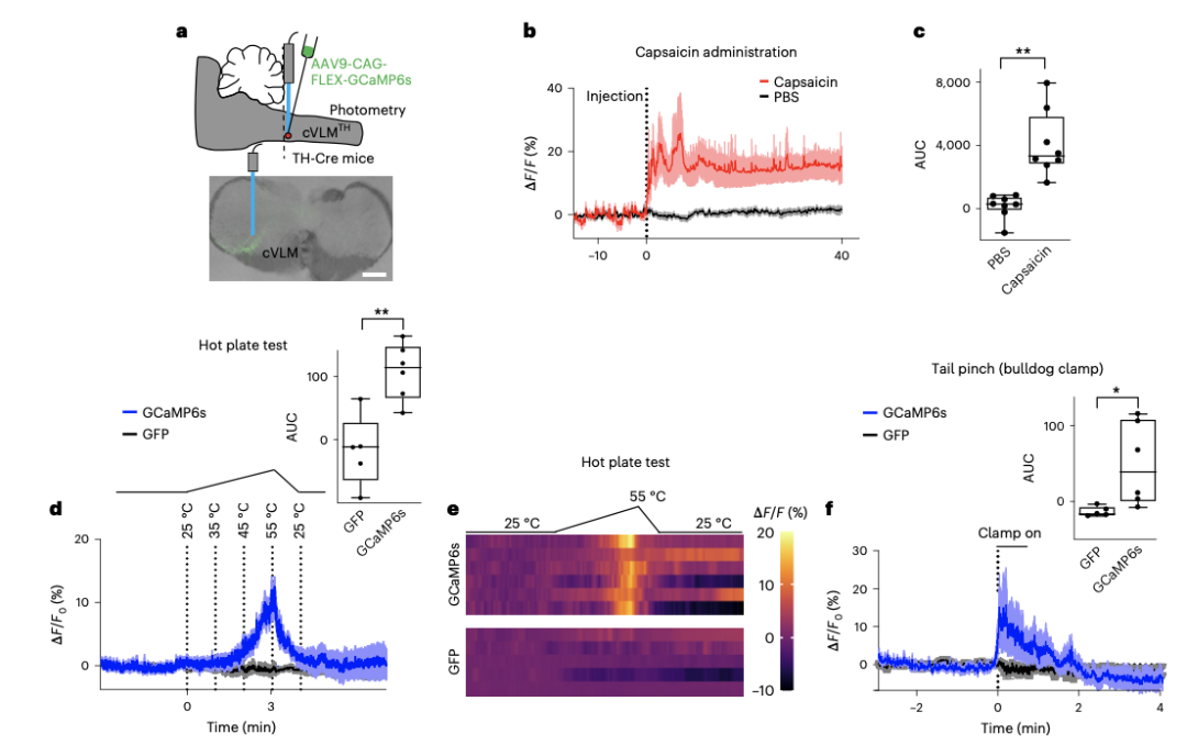 Nature Neurosci：疼痛调控新神经环路