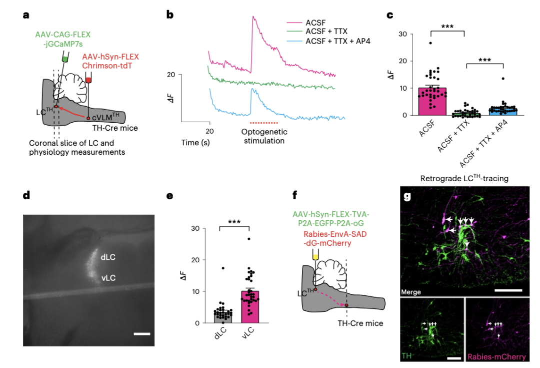 Nature Neurosci：疼痛调控新神经环路__财经头条
