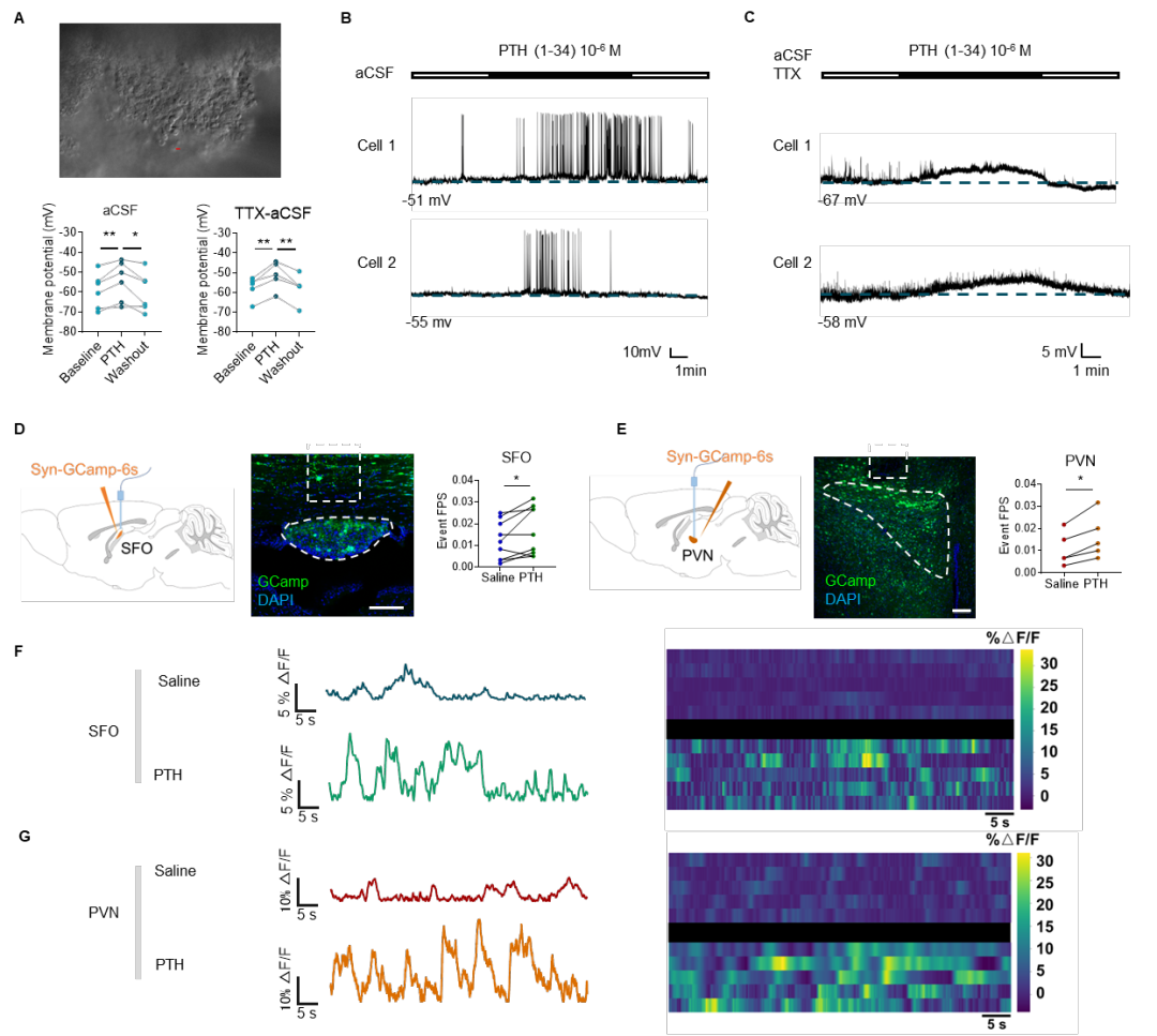 专家点评| Neuron: 杨帆/吕维加报道大脑调控甲状旁腺素分泌新机制__财经头条